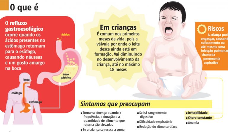 Refluxo gastroesofágico – ObservaPed