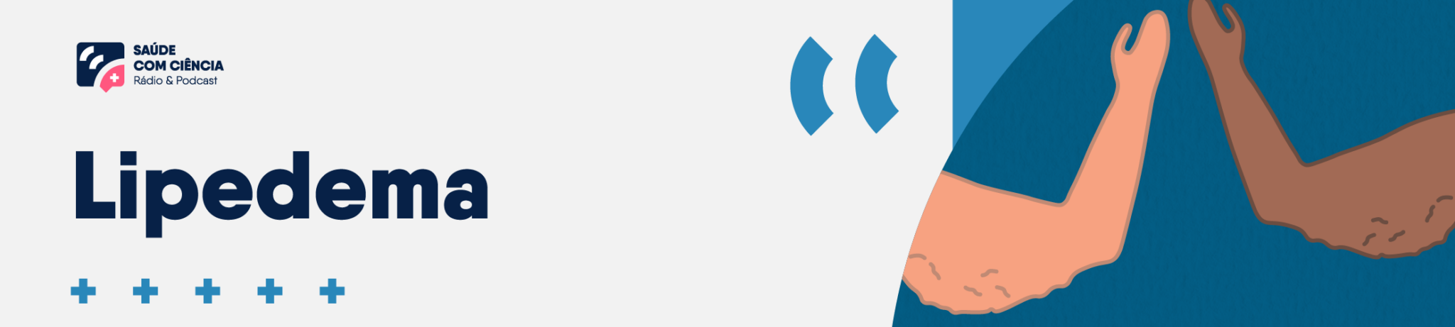 Lipedema – Saúde com Ciência