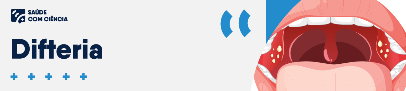 Difteria – Saúde com Ciência