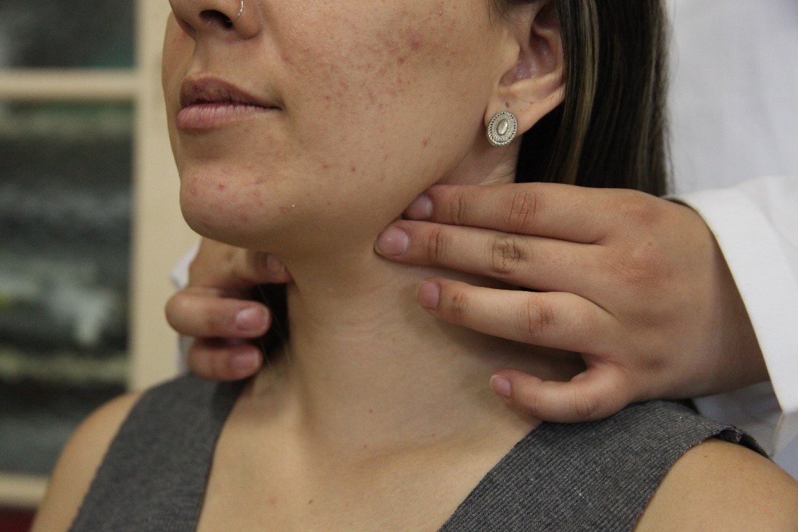 Conheça a tireoidite de Hashimoto, uma das principais causas do ...